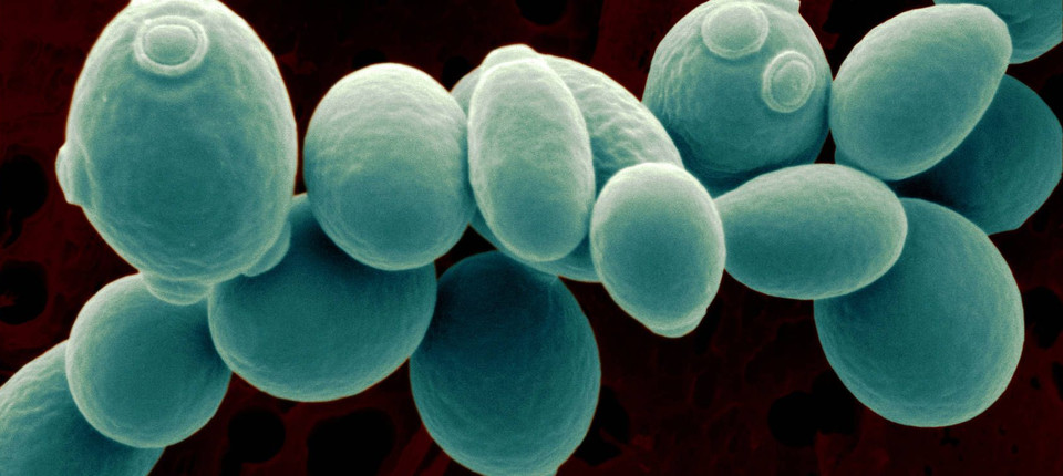 Künstliches Chromosom: Gen-Lego mit Hefezellen