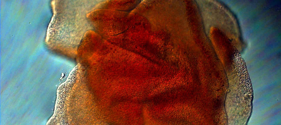 Trichoplax adhaerens ist ein seltsamer Meeresbewohner