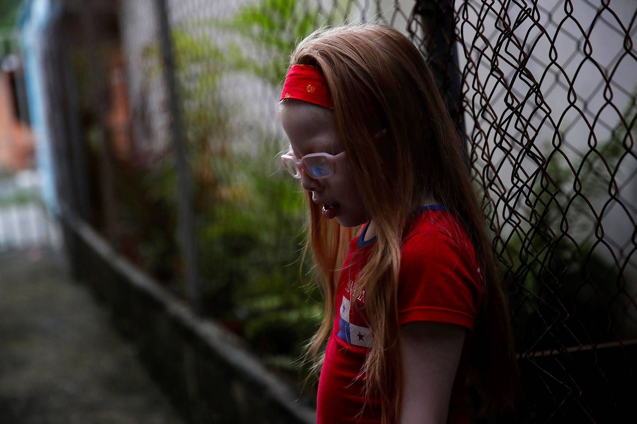 Albinismus in Panama: Die Kinder des Mondes