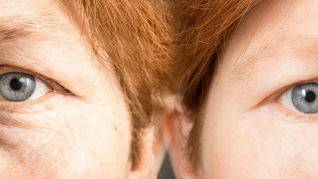 Anti-Aging: Stress lässt Zellen altern. Der Prozess ist aber umkehrbar ...