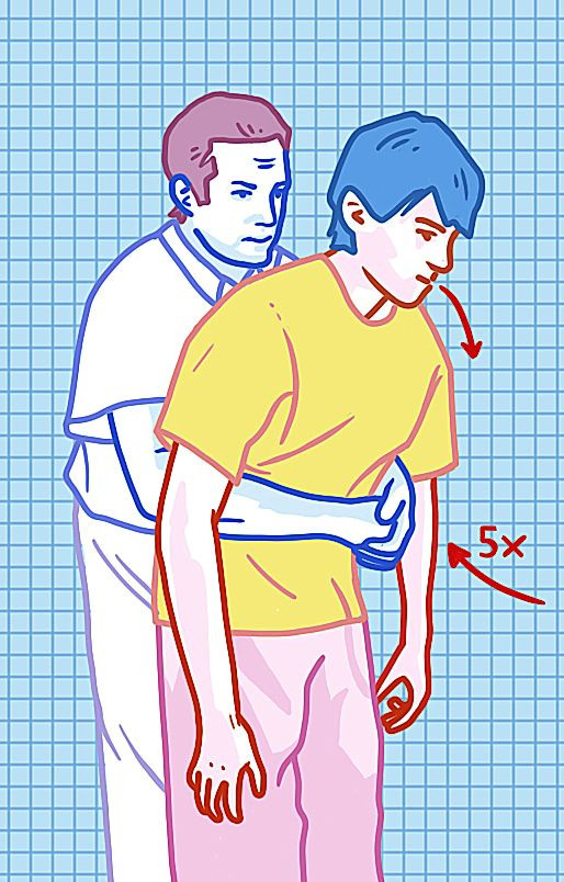 So geht erste Hilfe: Anleitung in Bildern